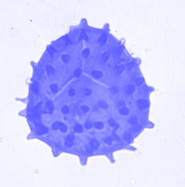 Biostratigraphy – MB Stratigraphy | Biostratigraphy and Palynology ...